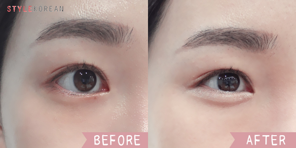 Aegyo Sal Without Makeup | Saubhaya Makeup